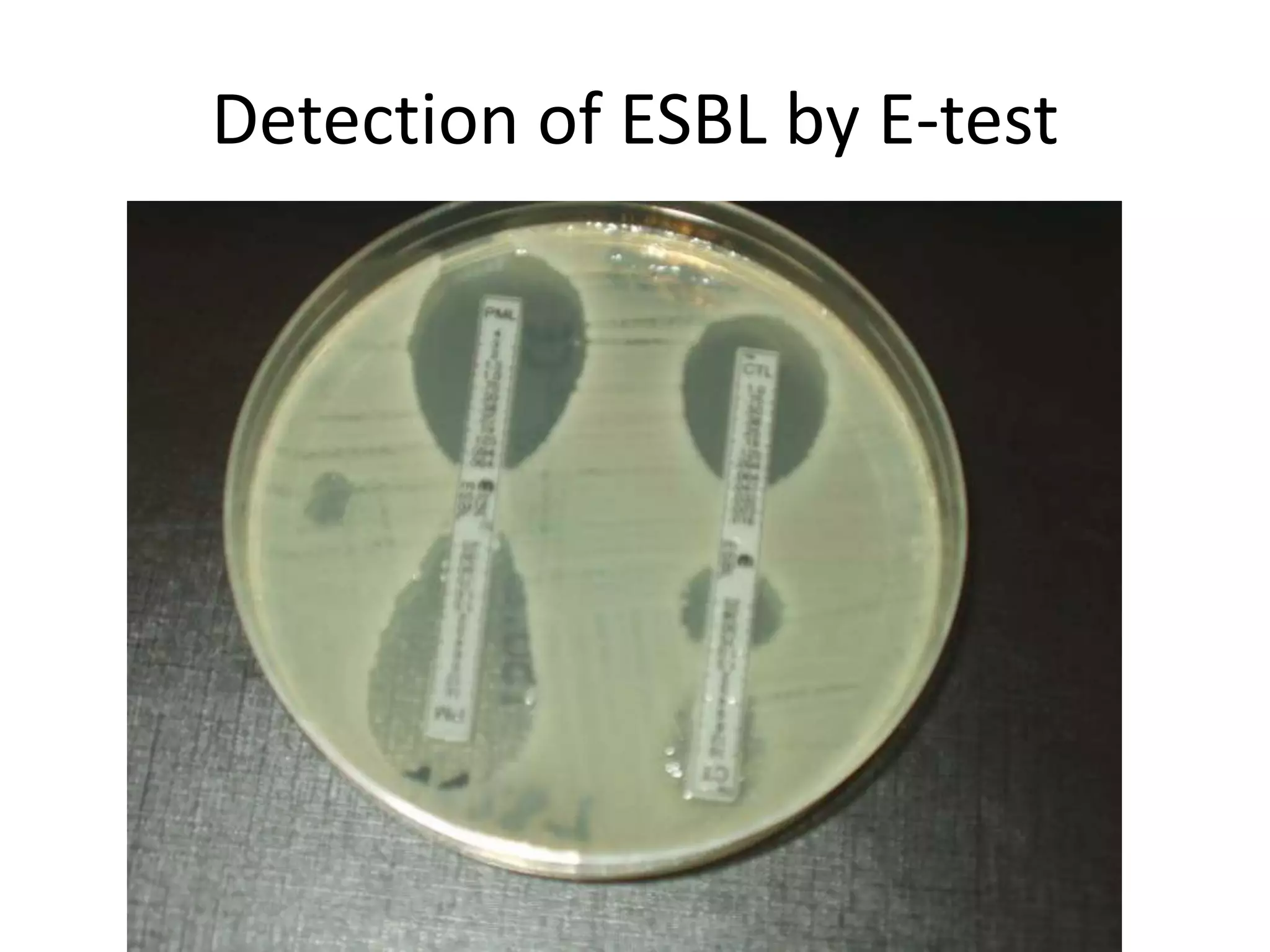 Laboratory detection of resistant bacteria | PPTX