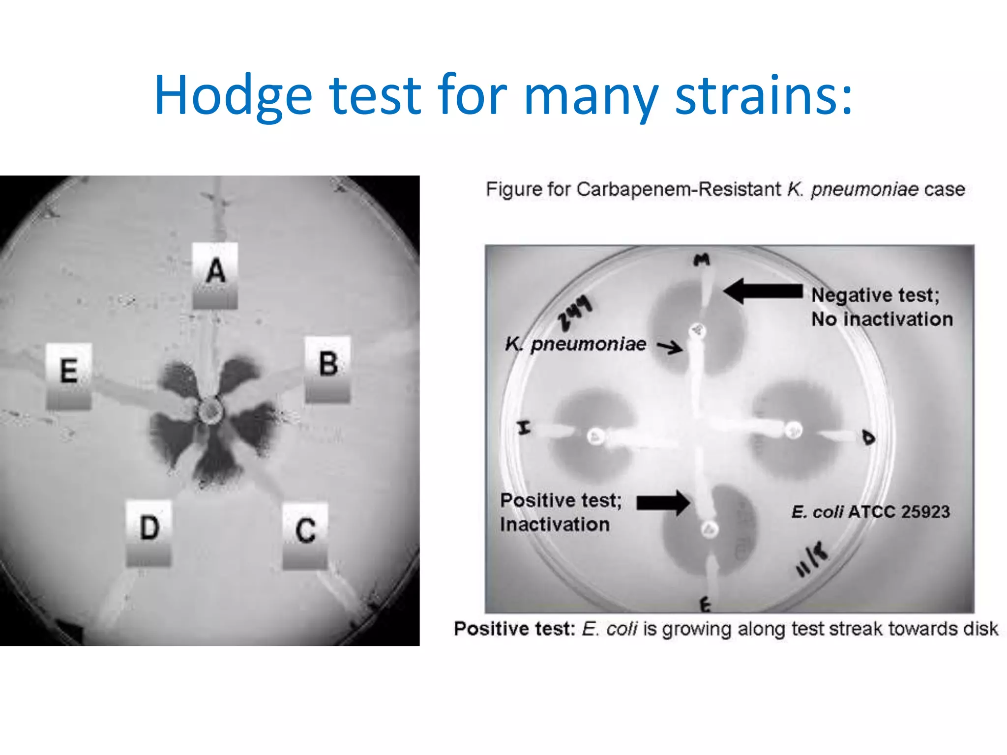 Laboratory detection of resistant bacteria | PPTX