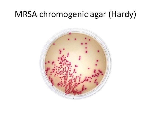 Laboratory detection of resistant bacteria