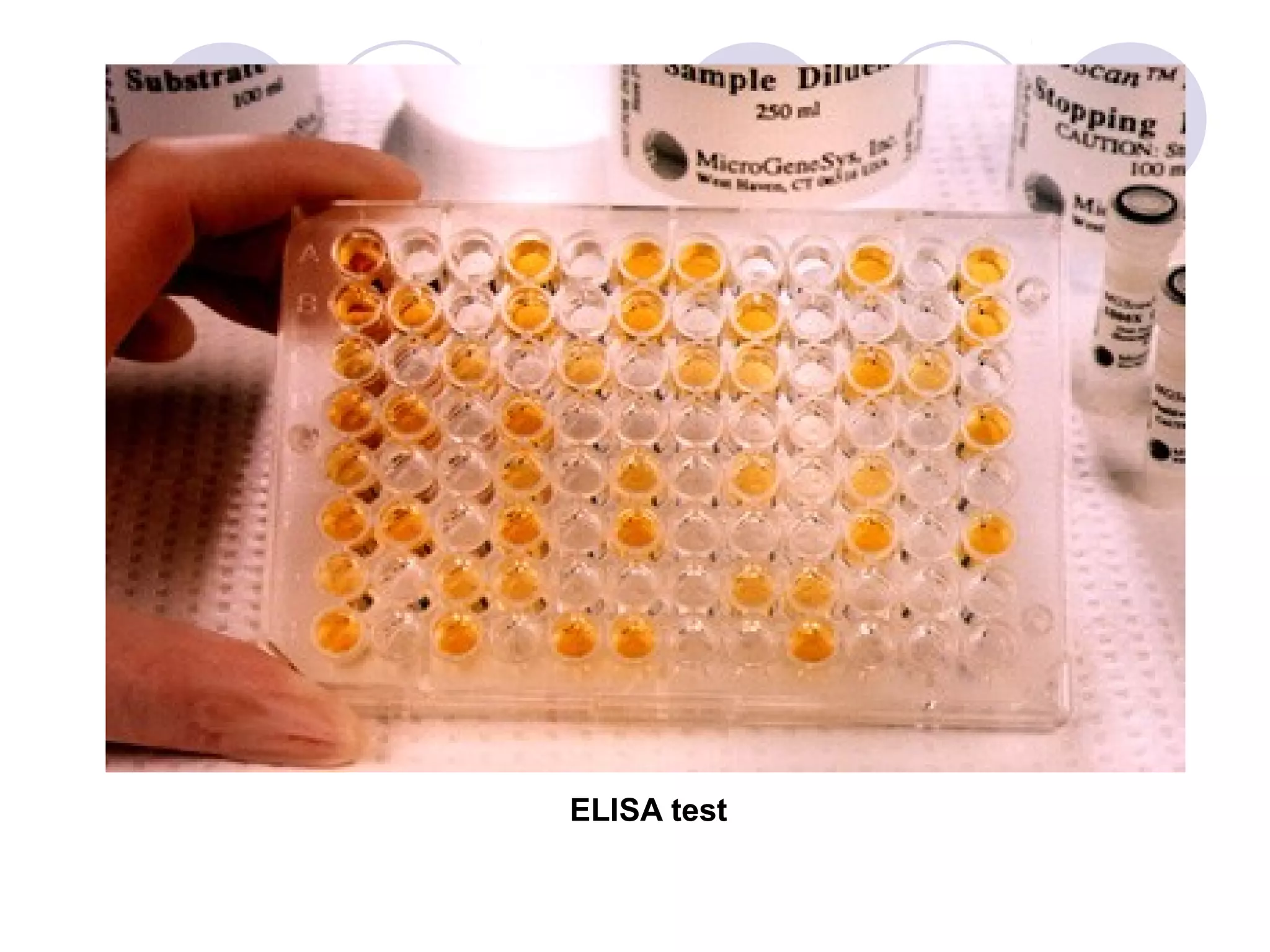 Laboratory diagnosis of HIV | PPT