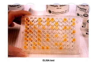 Laboratory diagnosis of HIV | PPT