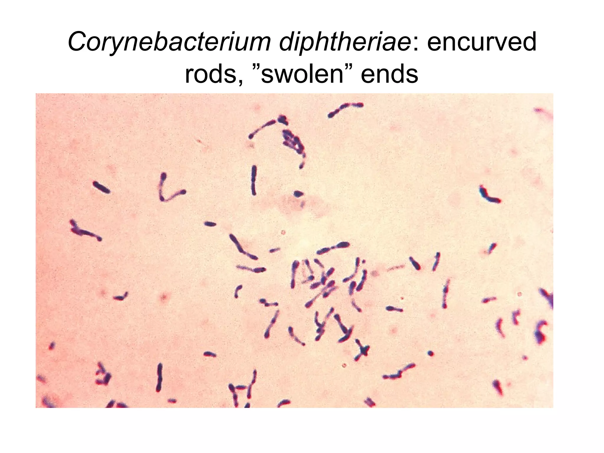 Laboratory diagnosis gram positive and gram negative bacilli | PPT