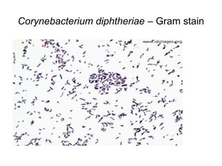 Laboratory diagnosis gram positive and gram negative bacilli | PPT