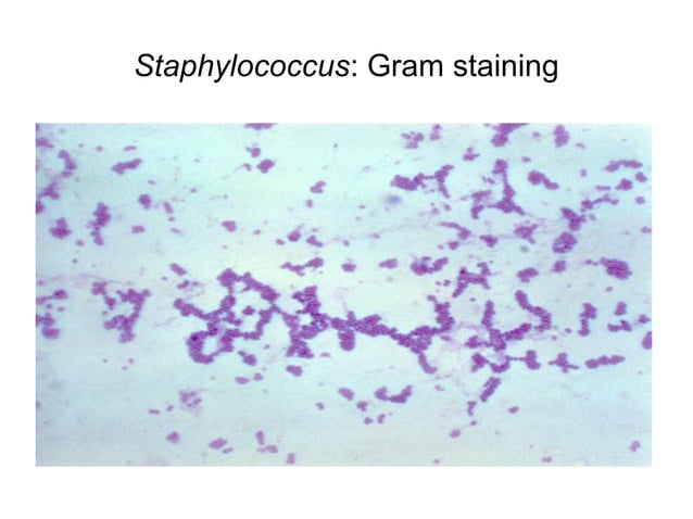 Laboratory diagnosis gram positive and gram negative cocci | PPT