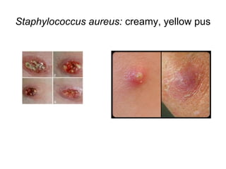 Laboratory diagnosis gram positive and gram negative cocci | PPT
