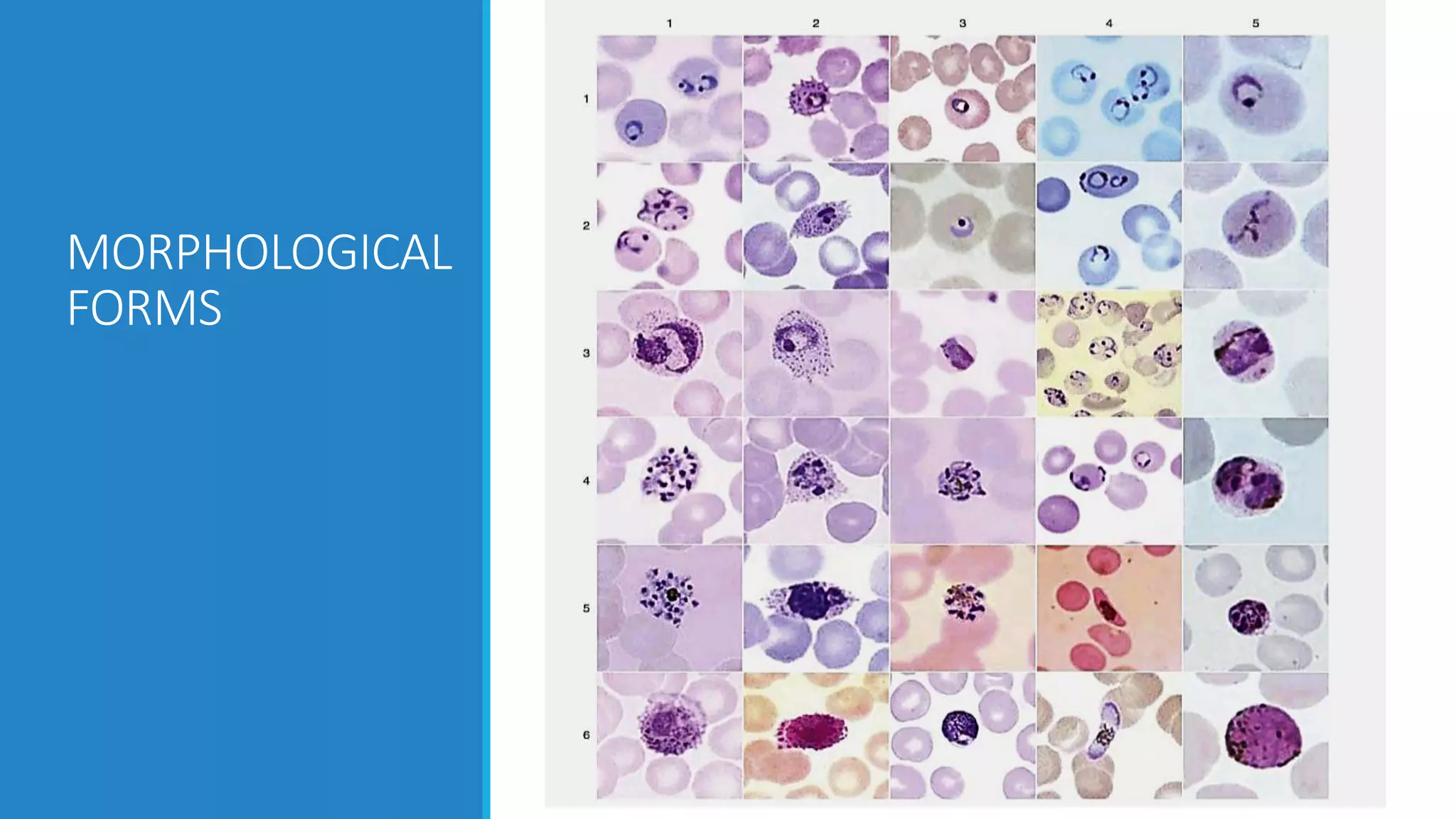 LABORATORY DIAGNOSIS OF malaria.pptx