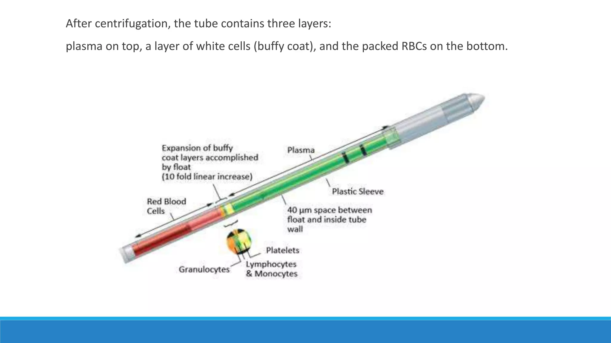 LABORATORY DIAGNOSIS OF malaria.pptx