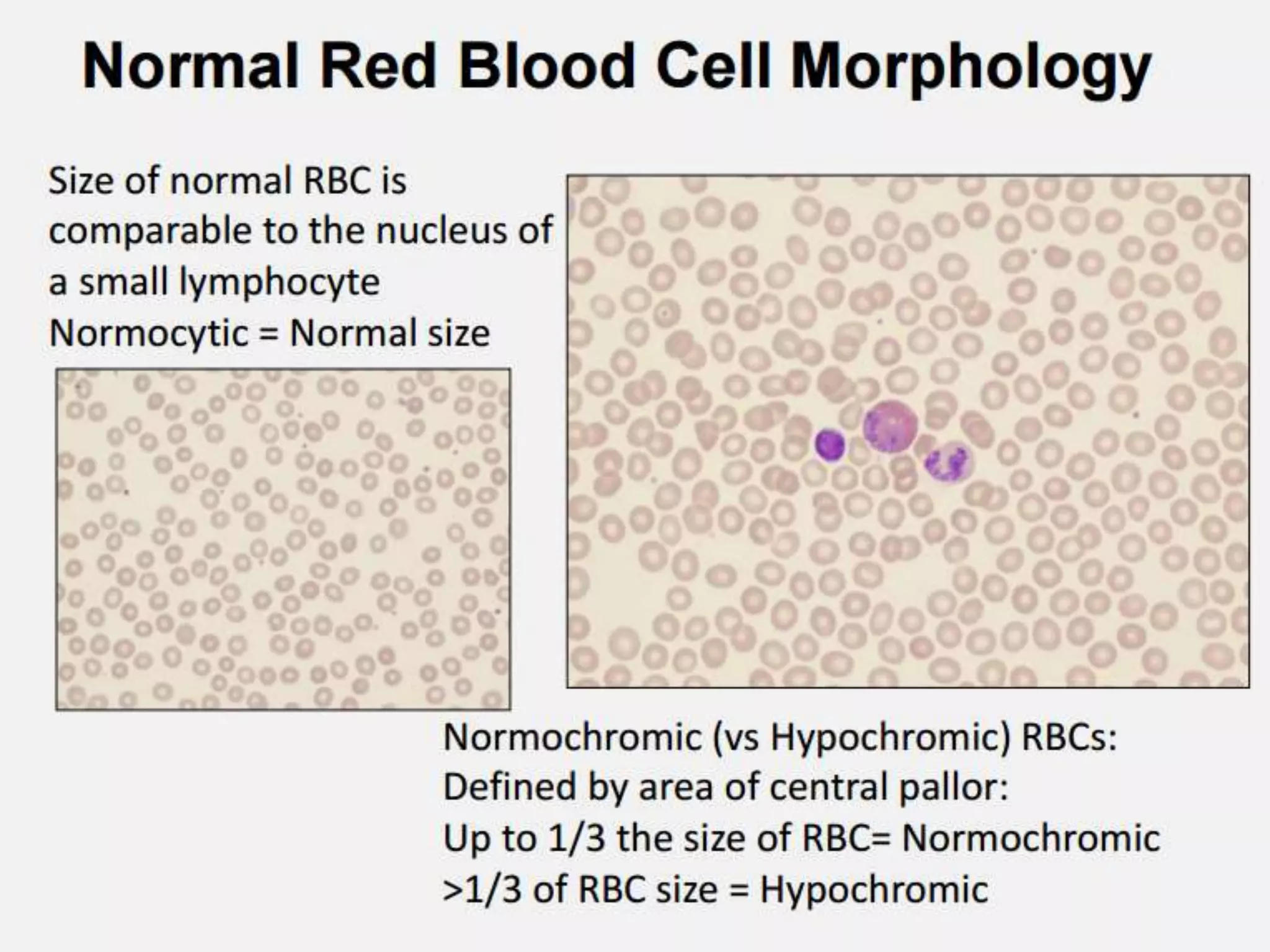 Laboratory diagnosis of anemia | PPTX