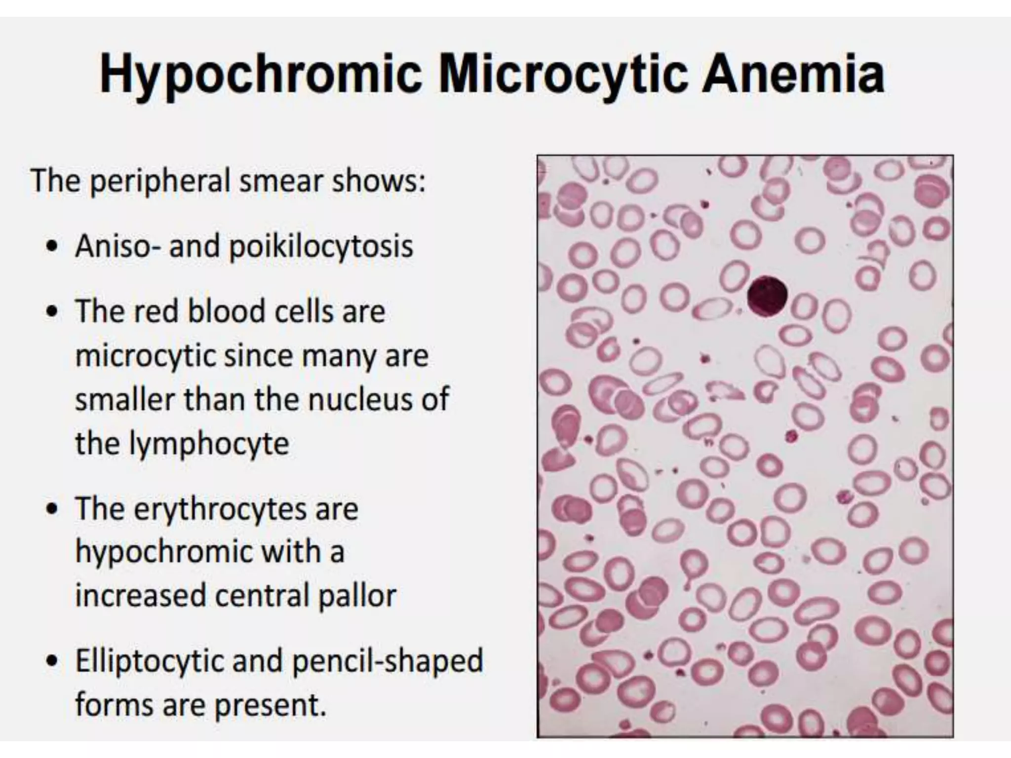 Laboratory diagnosis of anemia | PPTX
