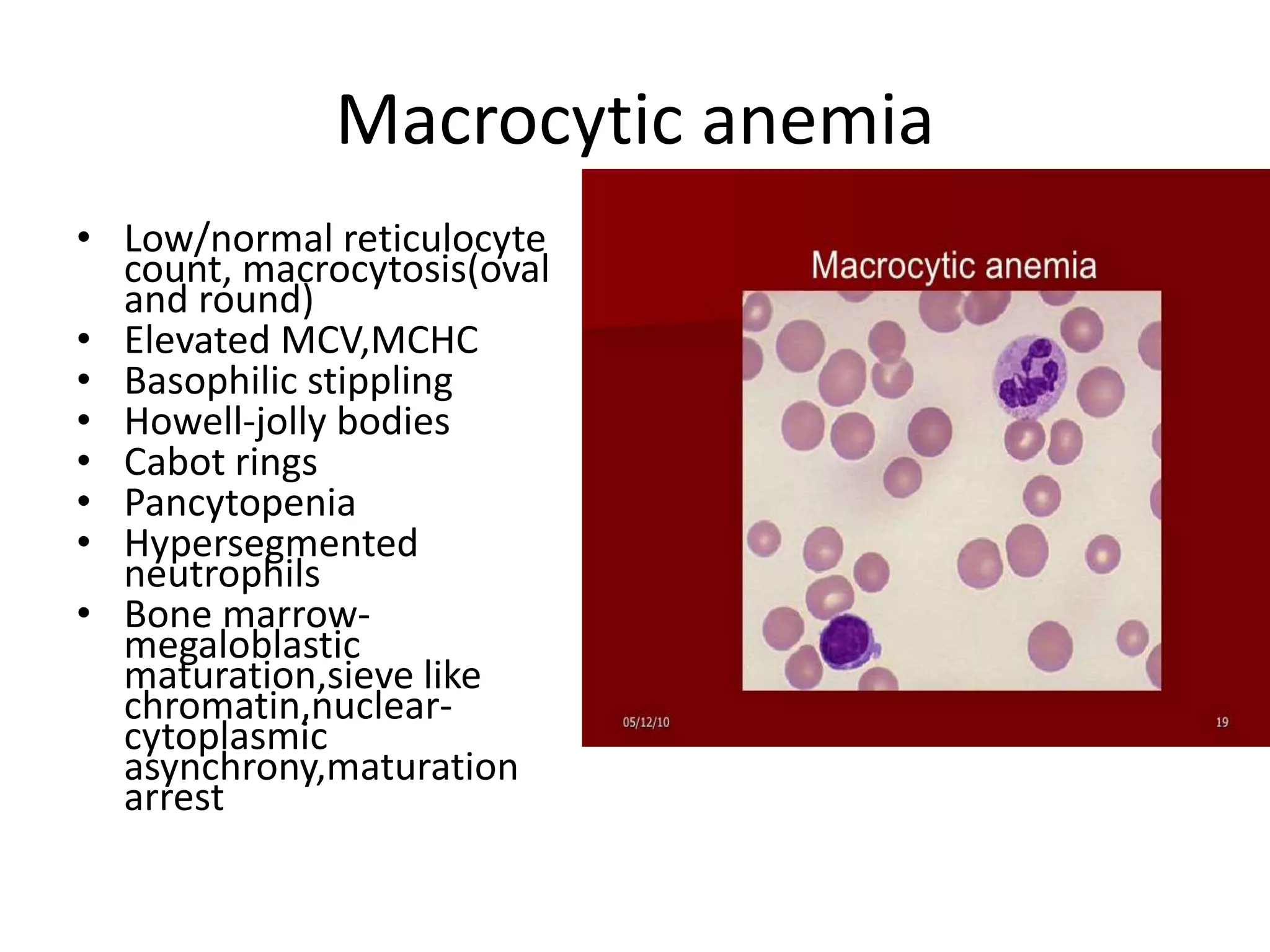 Laboratory diagnosis of anemia | PPTX
