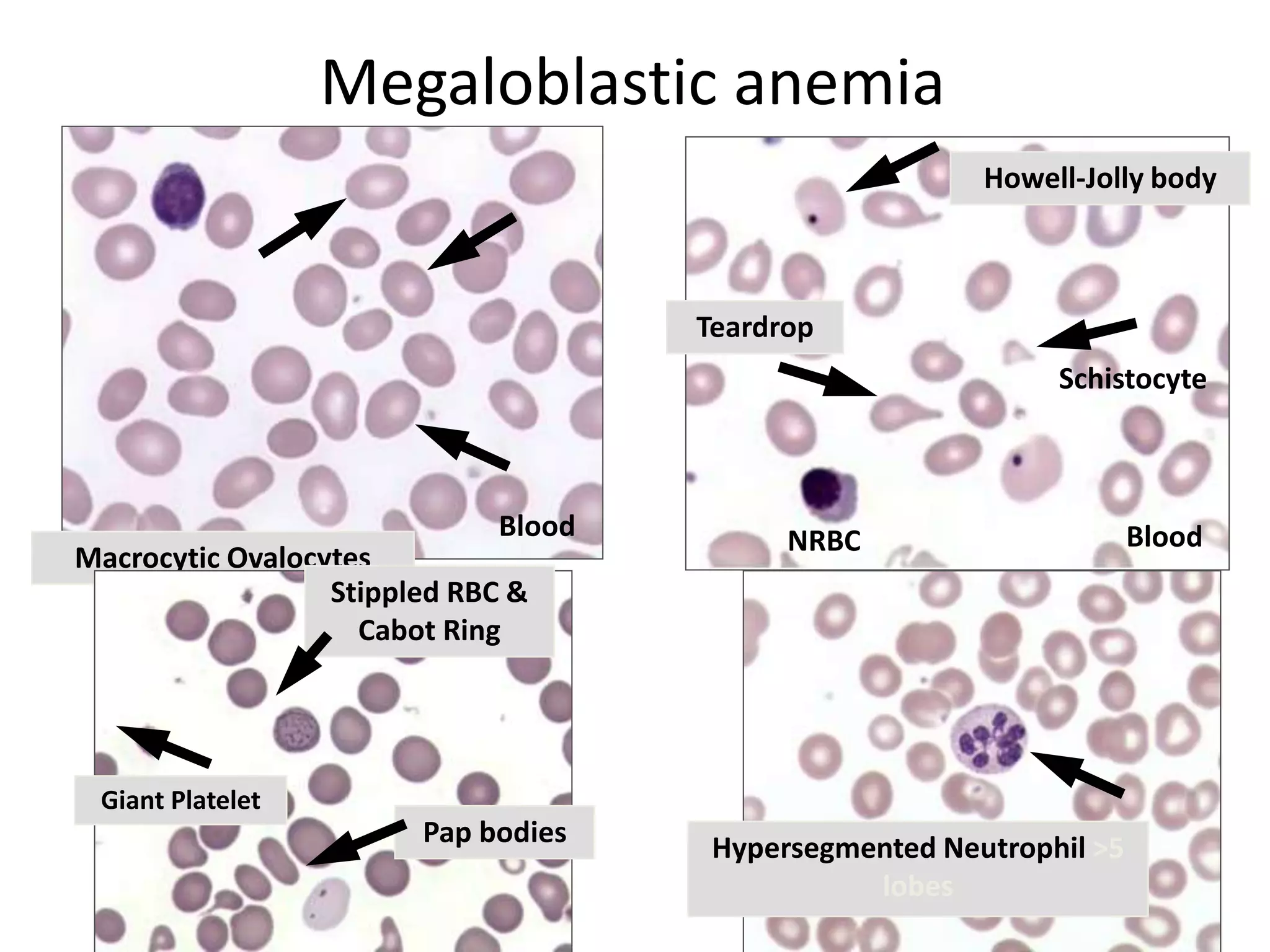 Laboratory diagnosis of anemia | PPTX