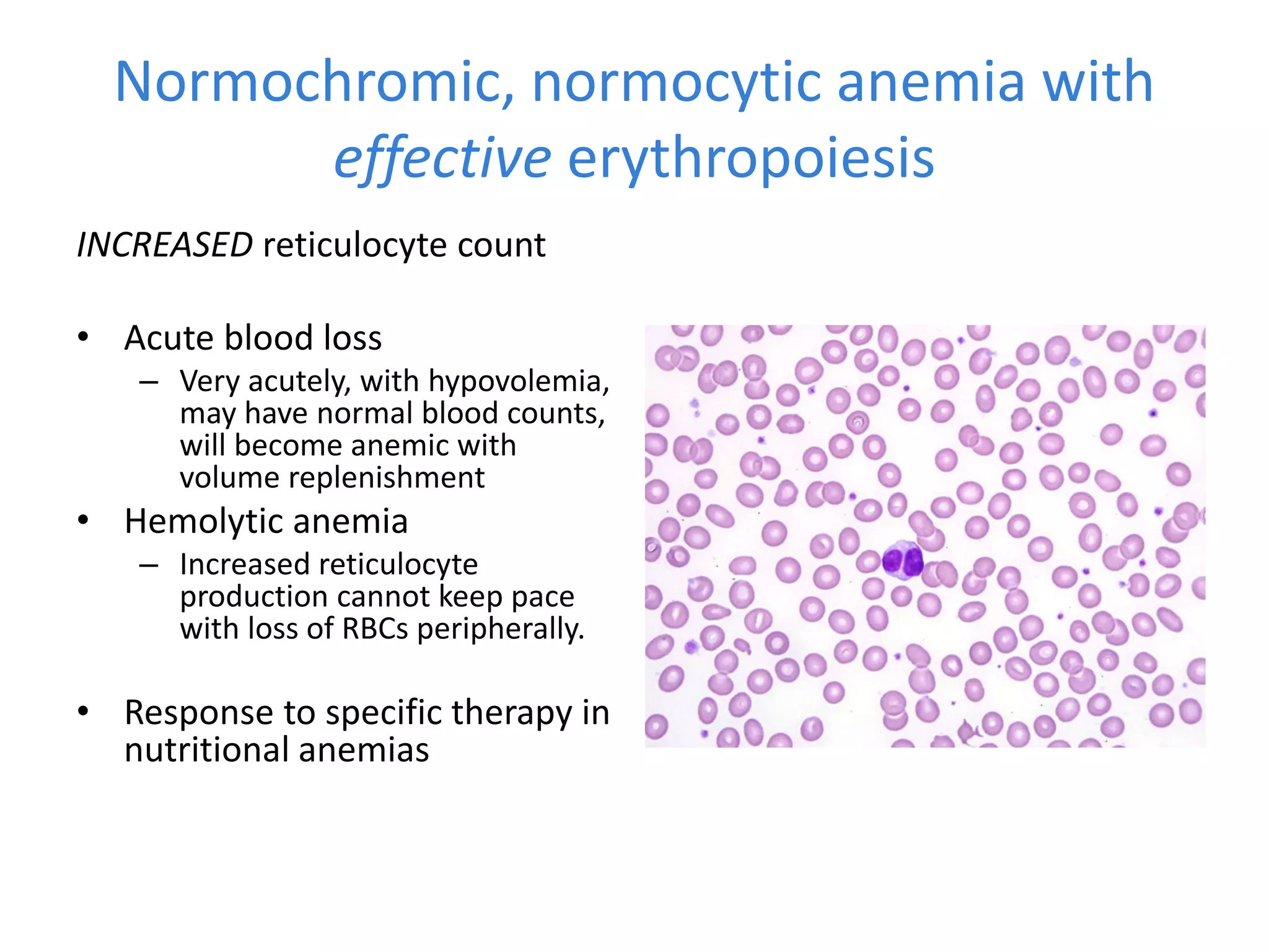 Laboratory diagnosis of anemia | PPTX