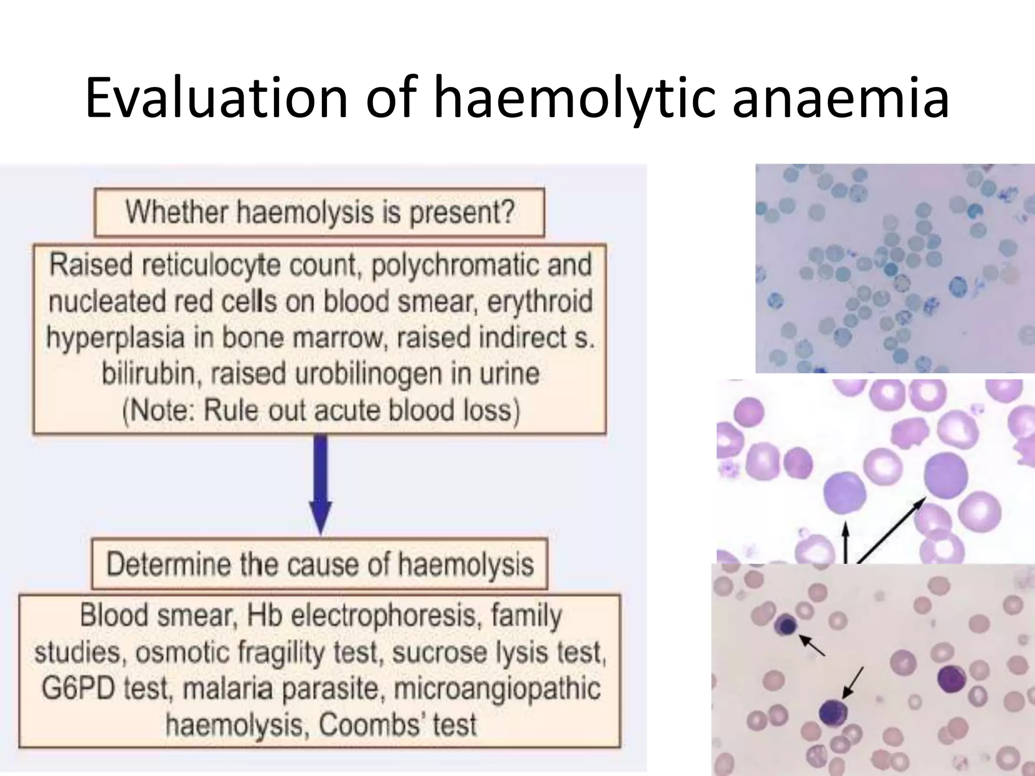 Laboratory diagnosis of anemia | PPTX