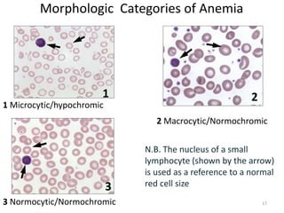 Laboratory diagnosis of anemia | PPTX