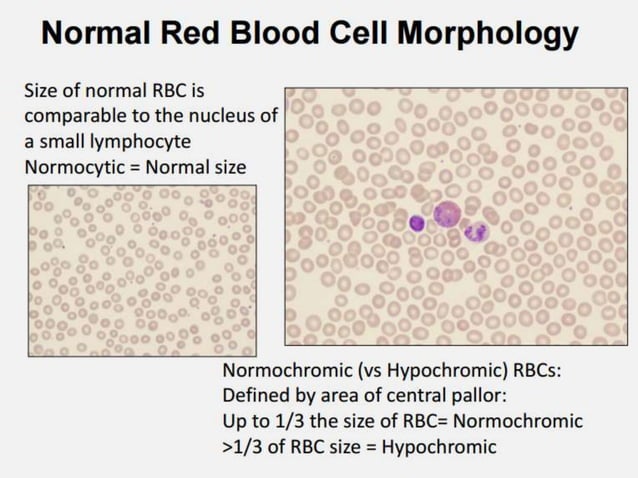 Laboratory diagnosis of anemia | PPTX