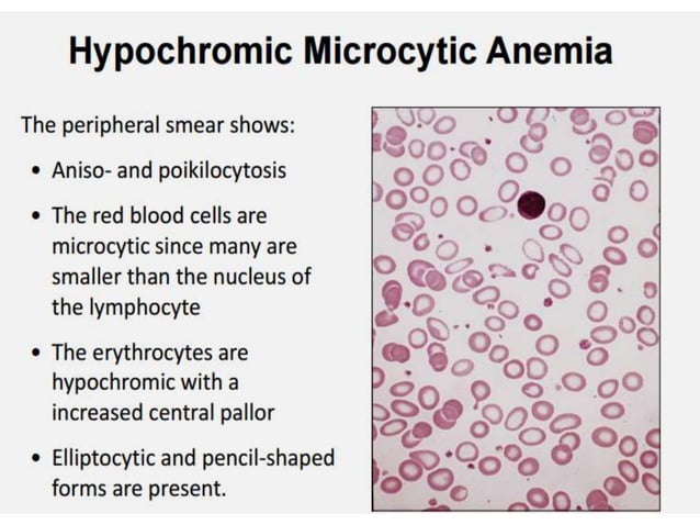Laboratory diagnosis of anemia | PPTX