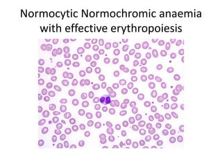 Laboratory diagnosis of anemia | PPTX