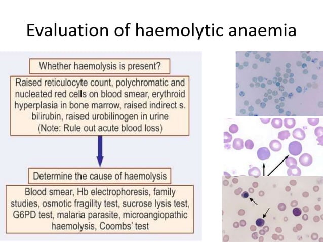 Laboratory diagnosis of anemia | PPTX