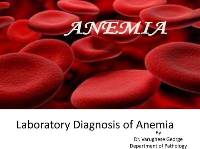 Laboratory diagnosis of anemia | PPT