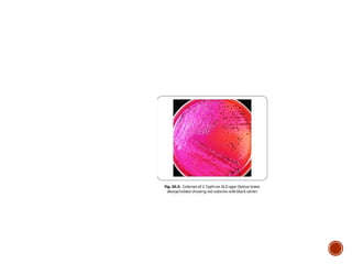 Laboratory_Diagnosis_of_Enteric_Fever_Detailed[1].pptx