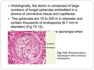 Laboratory diagnosis of fungal diseases | PPTX