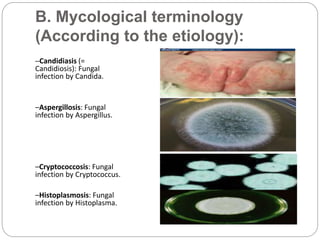 Candida Rhizoids In Stool