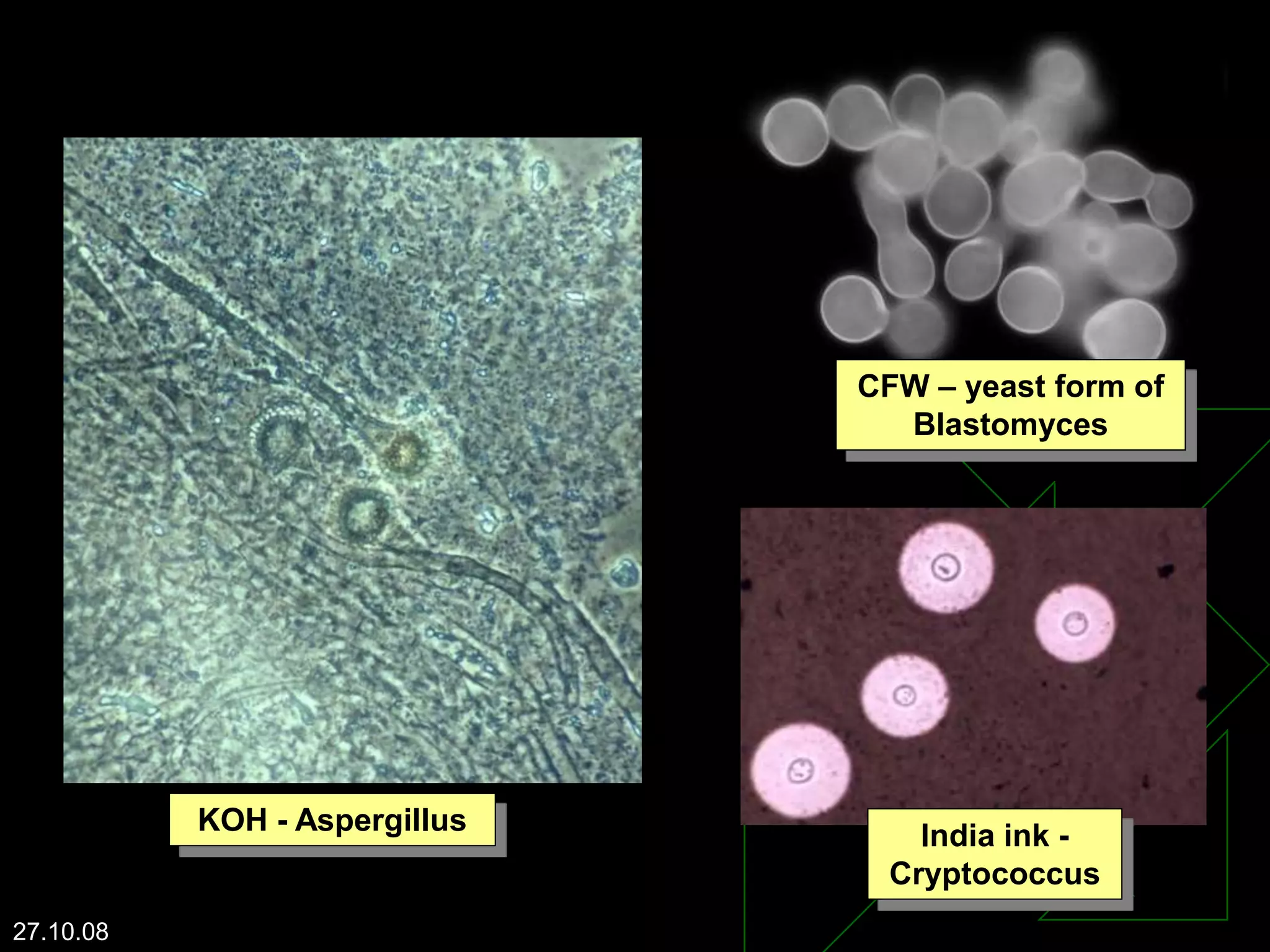Laboratory diagnosis of fungal infections | PPT