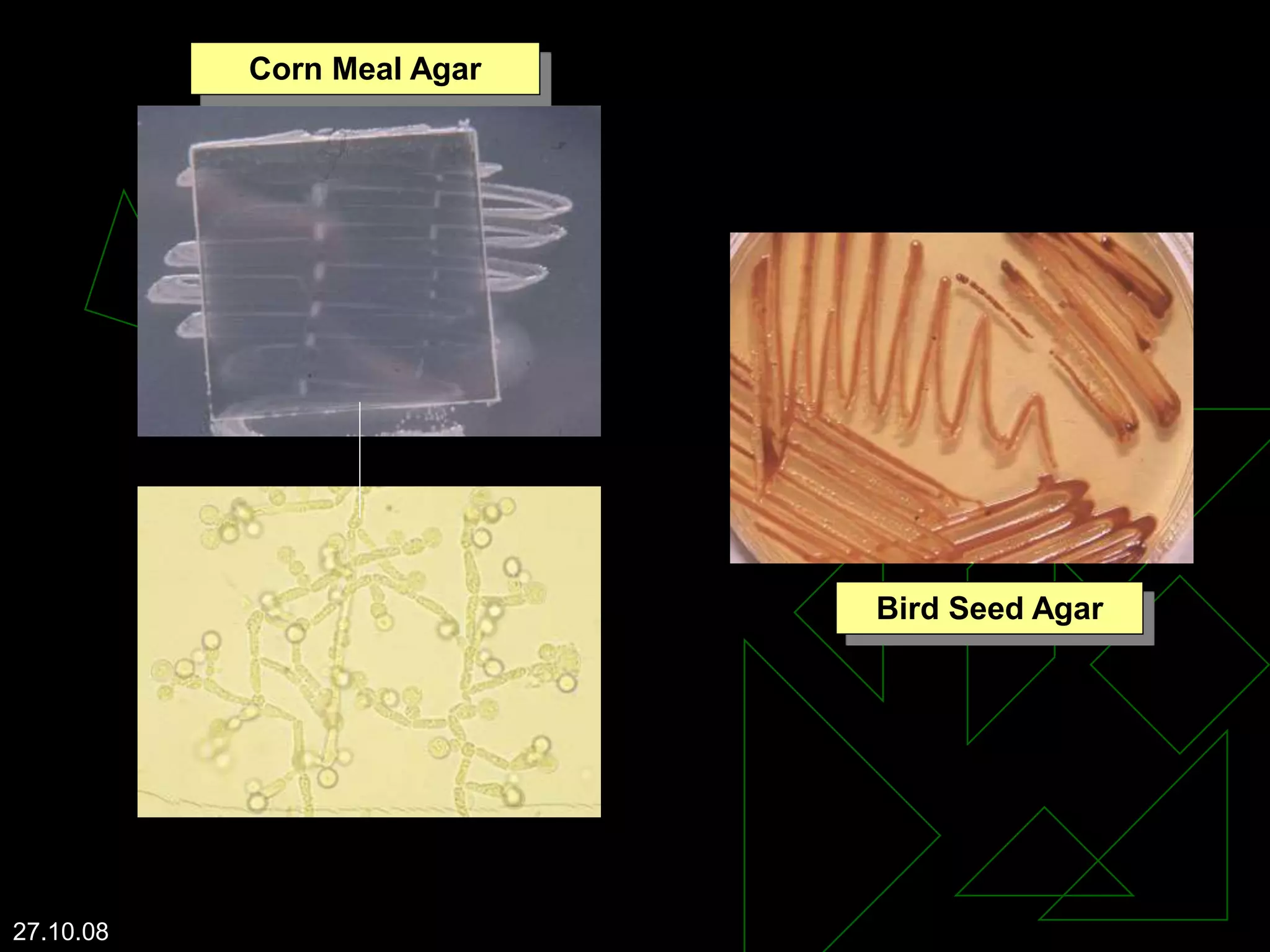 Laboratory diagnosis of fungal infections | PPT