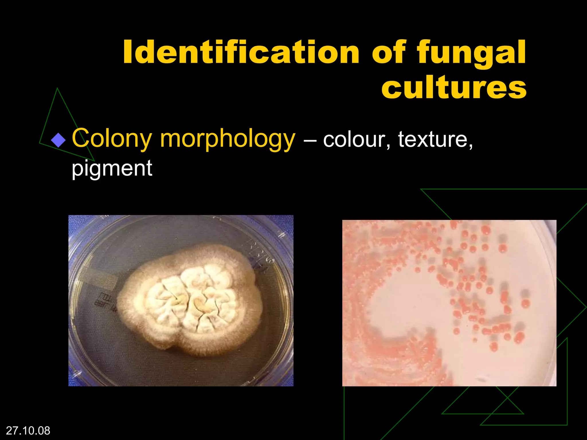 Laboratory diagnosis of fungal infections | PPT