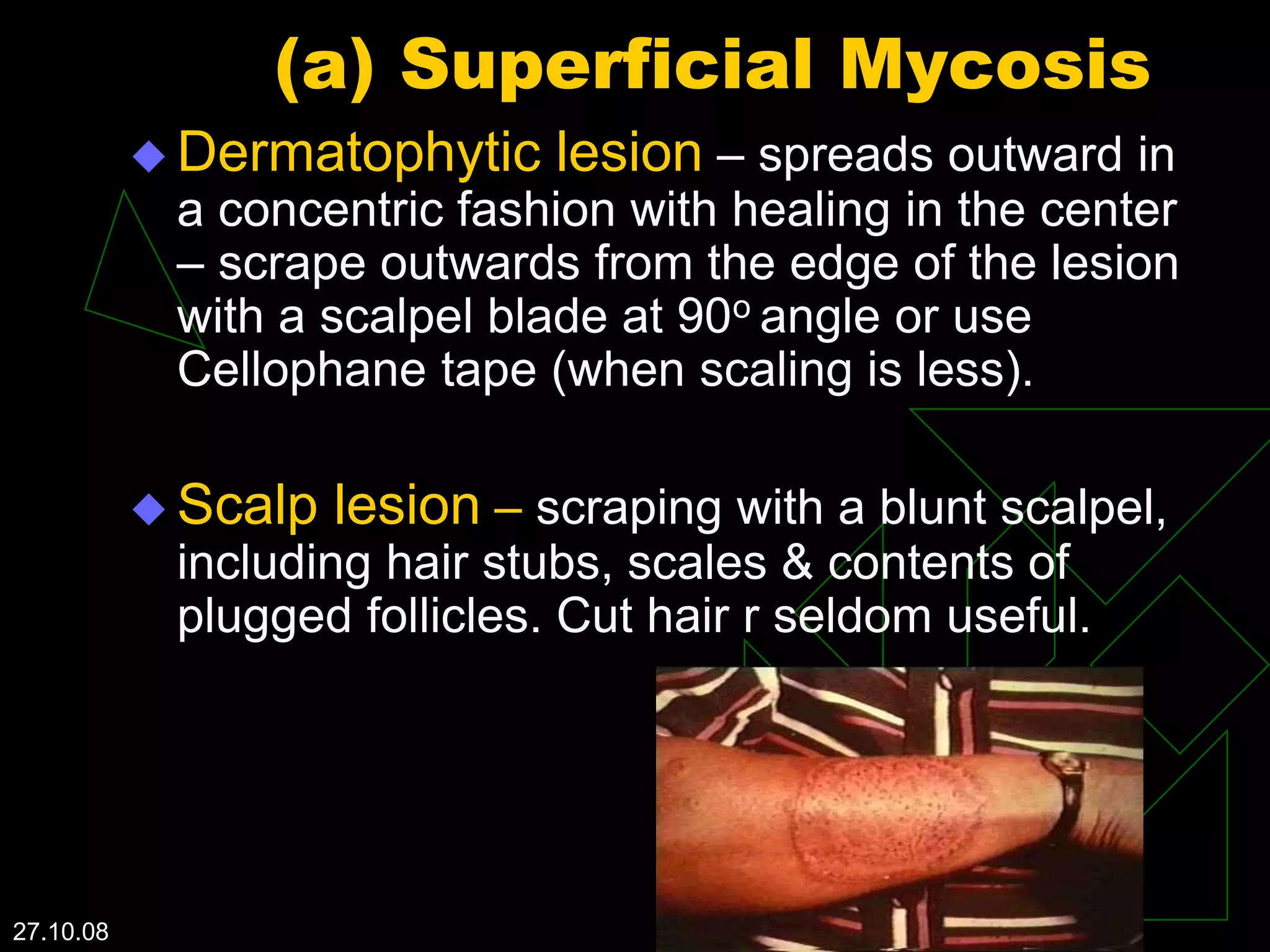 Laboratory diagnosis of fungal infections | PPT