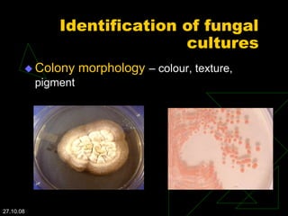 Laboratory diagnosis of fungal infections | PPT