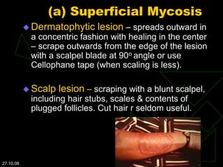 Laboratory diagnosis of fungal infections | PPT