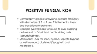 Laboratory Diagnosis of Fungal Infections | PDF