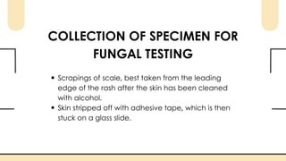 Laboratory Diagnosis of Fungal Infections | PDF