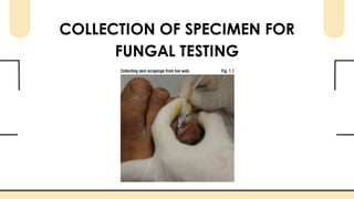 Laboratory Diagnosis of Fungal Infections | PDF
