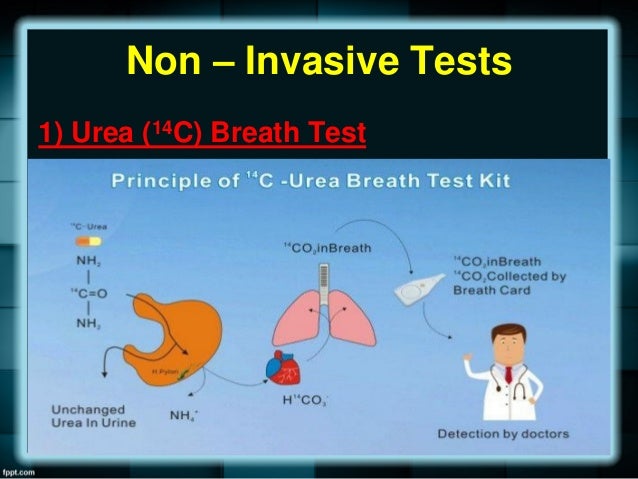 Laboratory diagnosis of H. Pylori infection, Ola Elgaddar