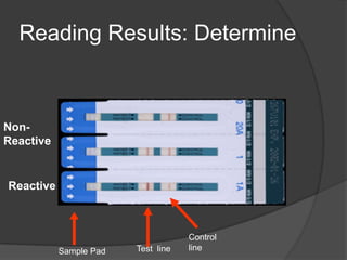 Laboratory diagnosis of hiv infections | PPTX | Infectious Diseases ...