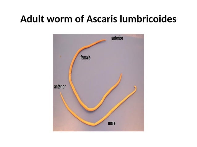 Laboratory diagnosis of infection due to Intestinal Nematodes.pptx