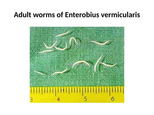 Laboratory diagnosis of infection due to Intestinal Nematodes.pptx