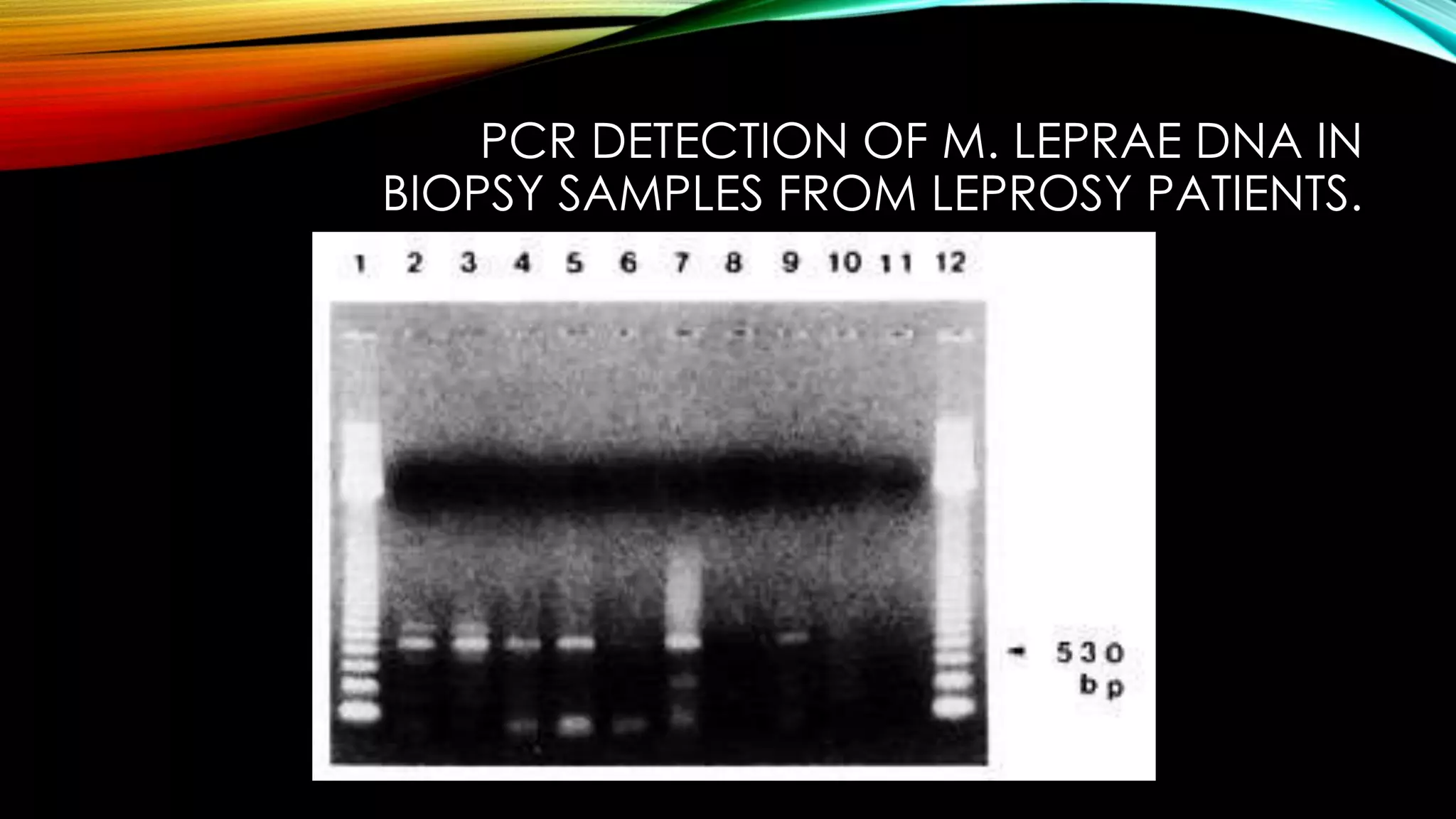 Laboratory diagnosis of leprosy | PPTX