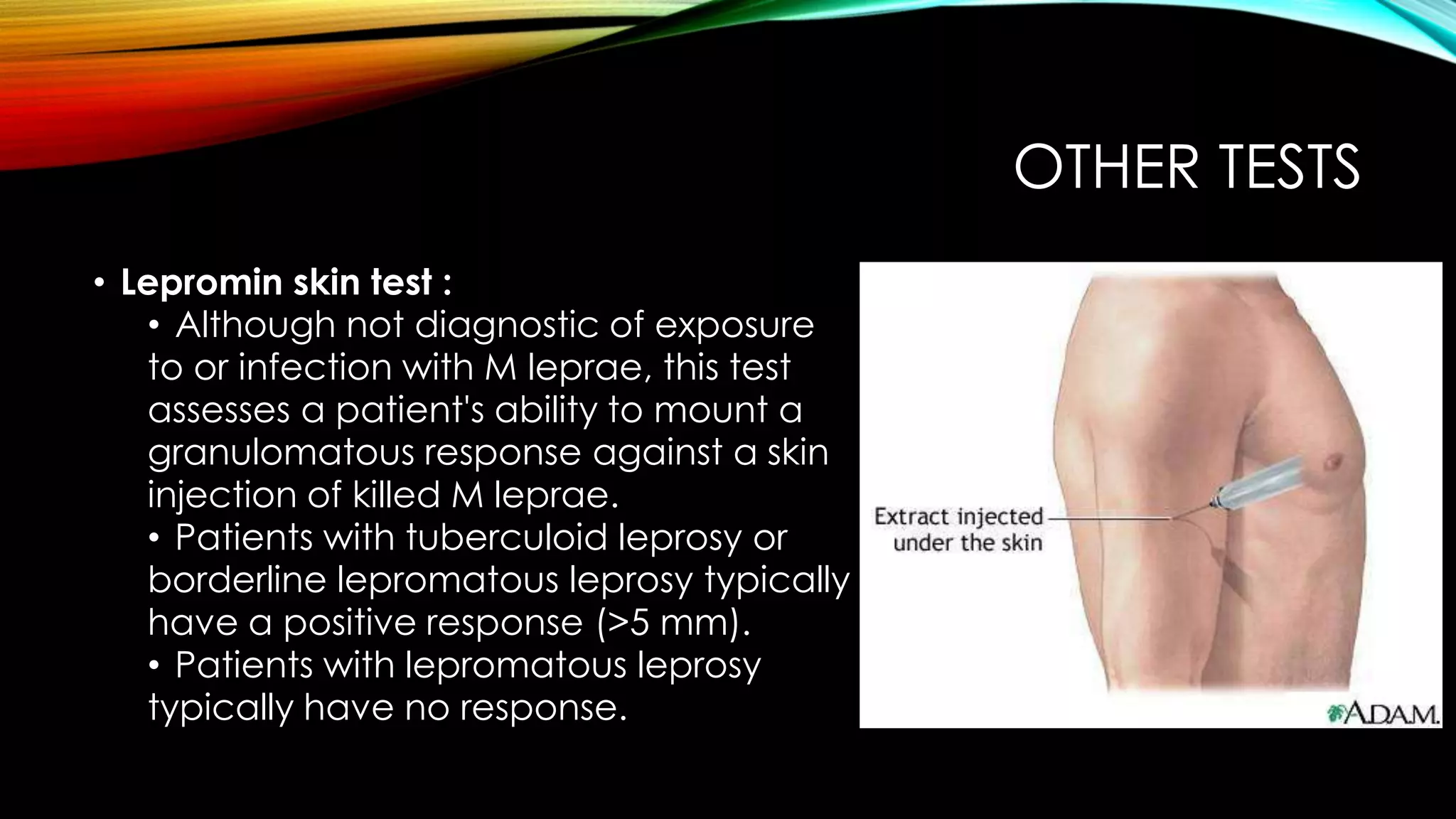 Laboratory diagnosis of leprosy | PPTX