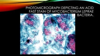 Laboratory diagnosis of leprosy | PPTX