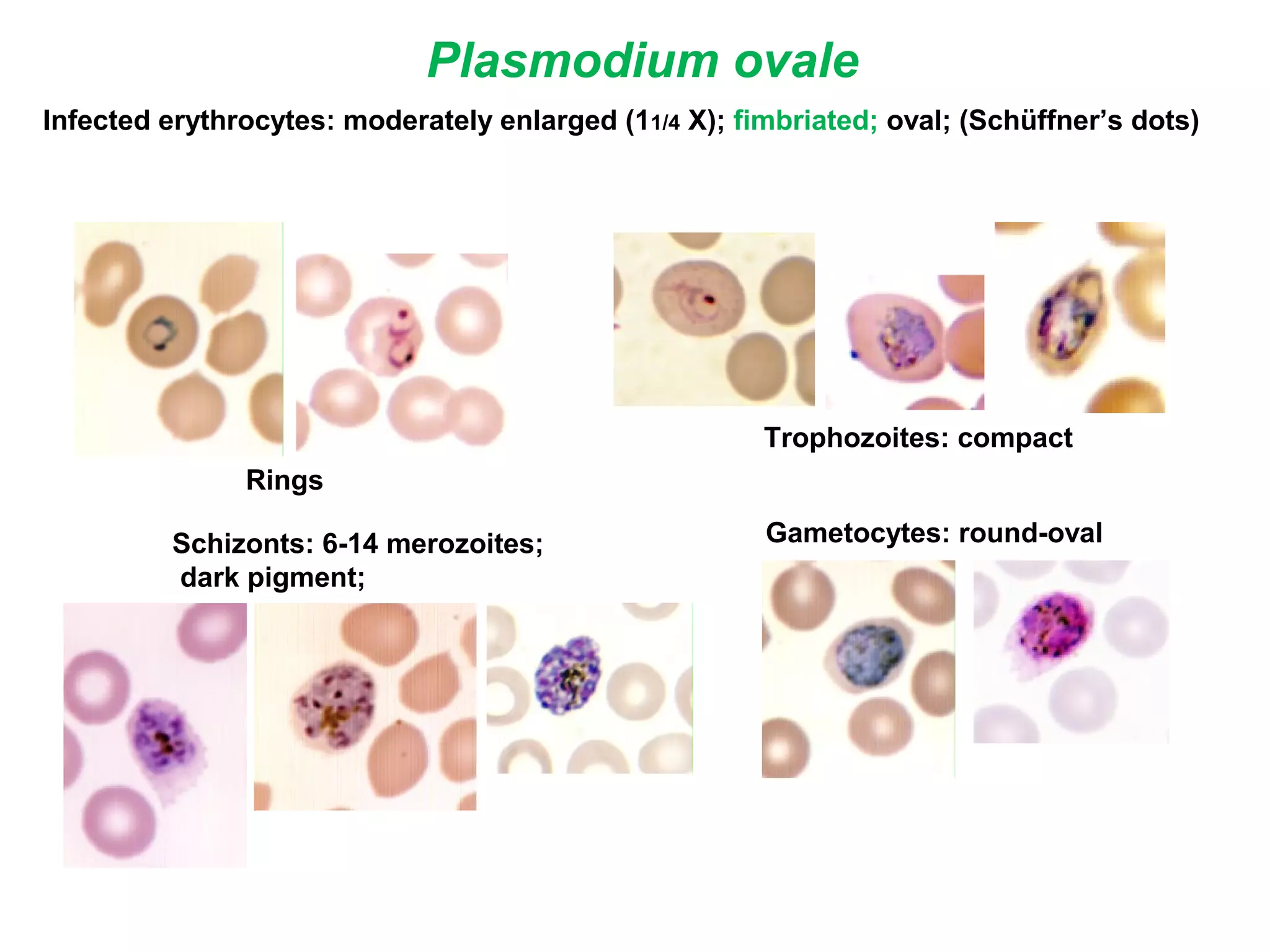 Laboratory diagnosis of malaria | PPT