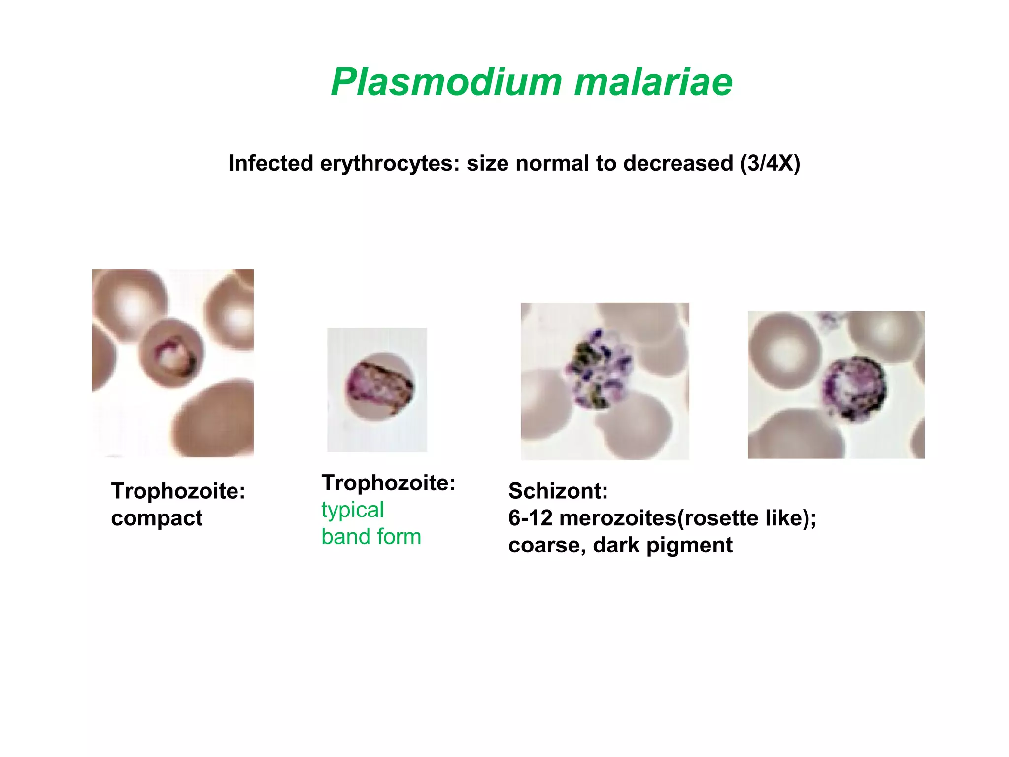 Laboratory diagnosis of malaria | PPT