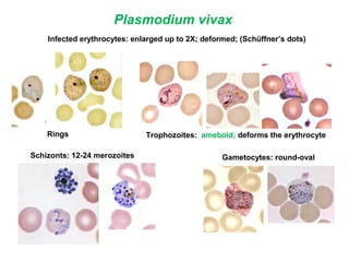 Laboratory diagnosis of malaria | PPT