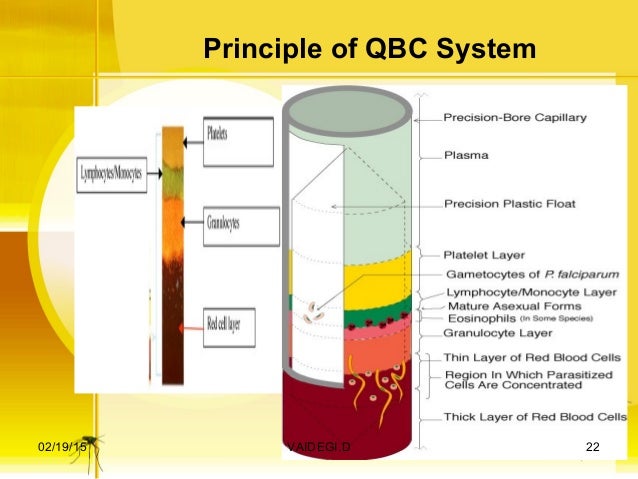 Quantitative Buffy Coat Qbc Test Principle Method And