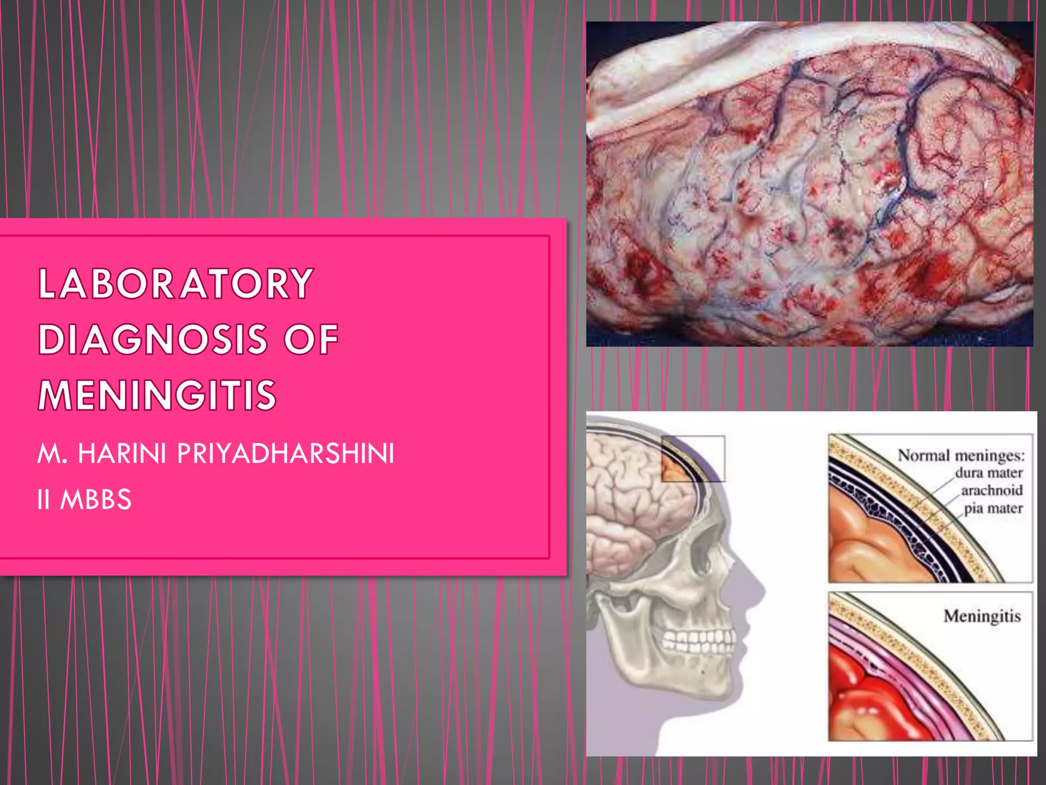 Laboratory diagnosis of meningitis | PPTX