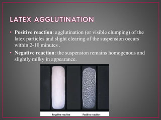 Laboratory diagnosis of meningitis | PPTX