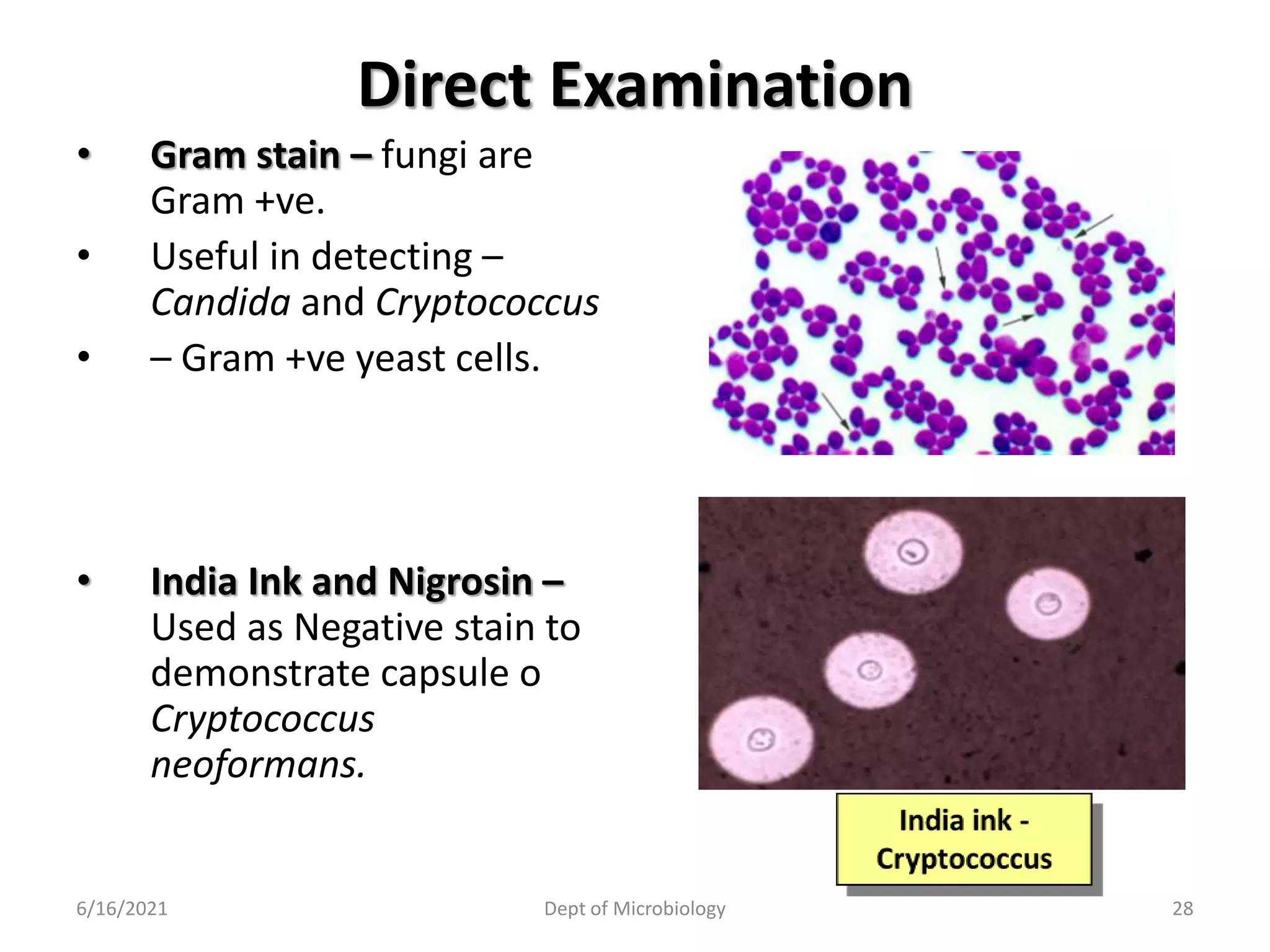 Laboratory diagnosis of mycology microscopy, staining techniques ...