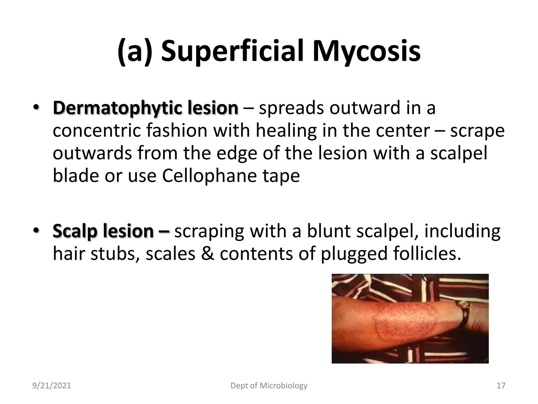Laboratory diagnosis of mycology microscopy, staining techniques ...